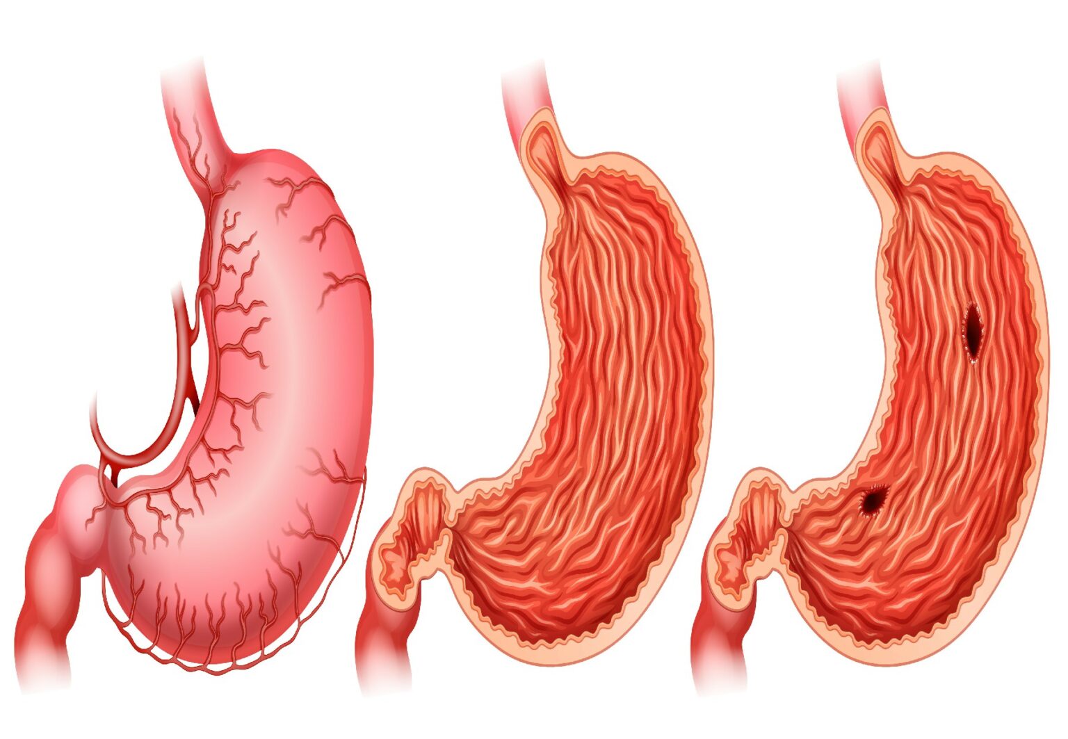 GASTROINTESTINAL CANCER - Marinas Clinic